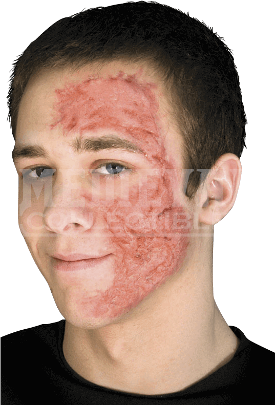 Congratulations! The PNG Image Has Been Downloaded (Burn Scar Face ...