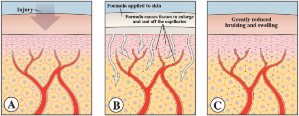 Congratulations! The PNG Image Has Been Downloaded (Bruise Repair ...