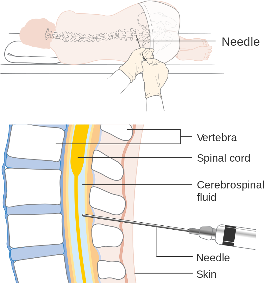 Congratulations! The PNG Image Has Been Downloaded (Diagram Showing A ...