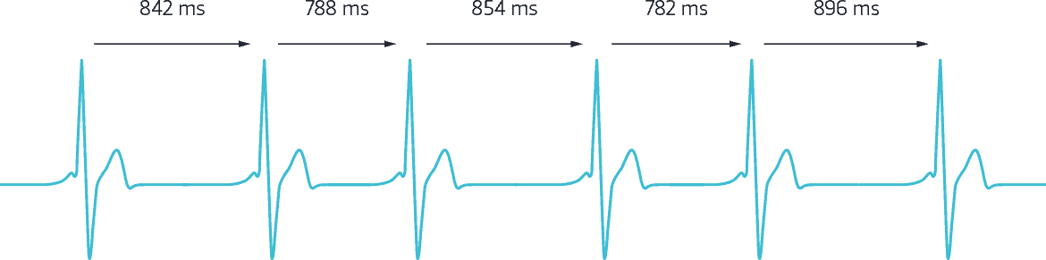 Congratulations! The PNG Image Has Been Downloaded (Heart Pulse Png ...