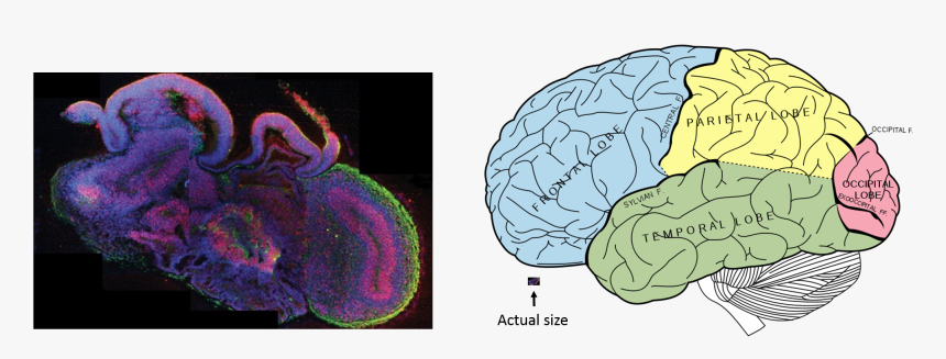Transparent Human Brain Clipart - Mini Brains, HD Png Download ...