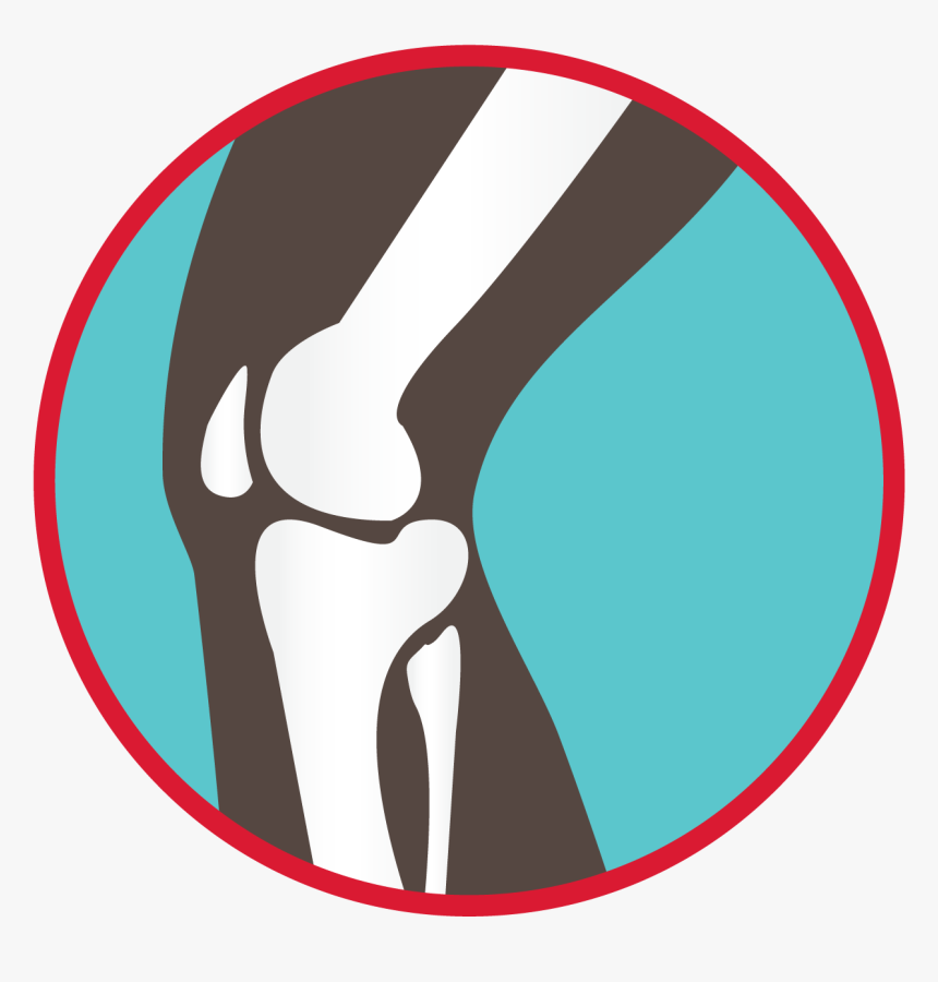 Bones Of The Knee Joint Graphic - Howth, HD Png Download , Transparent ...