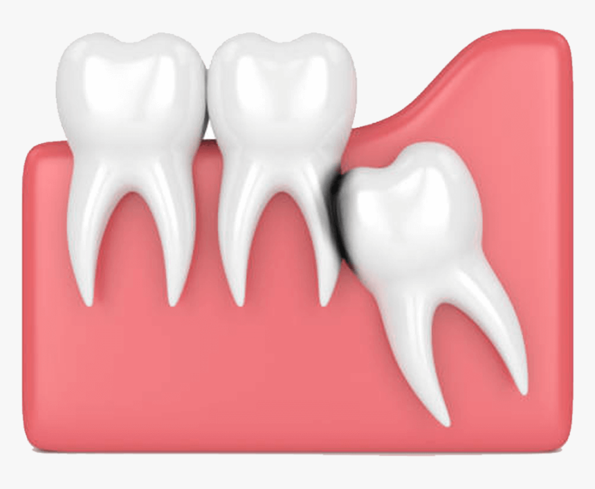 Wisdom Teeth, HD Png Download , Transparent Png Image - PNGitem