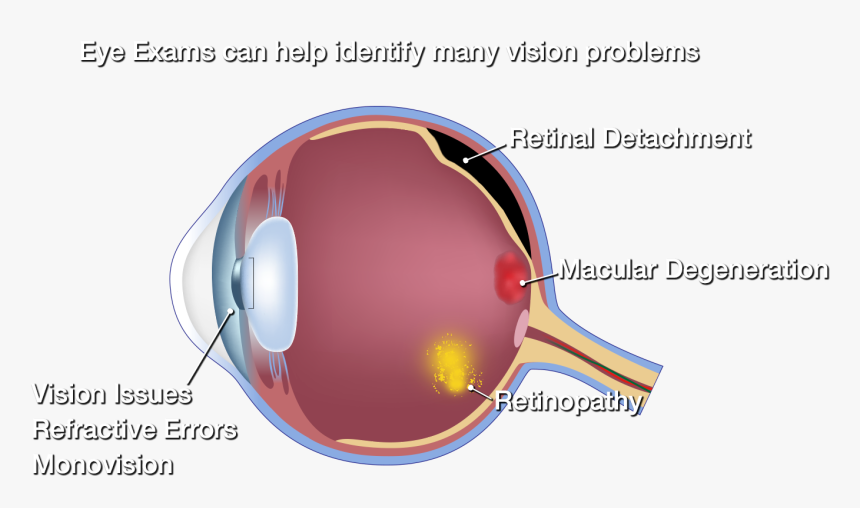 Side View Of Eyeball Side View Of Eyeball - Structure Of The Eye, HD ...