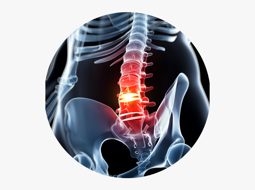 Slip Disc X Ray, HD Png Download , Transparent Png Image - PNGitem