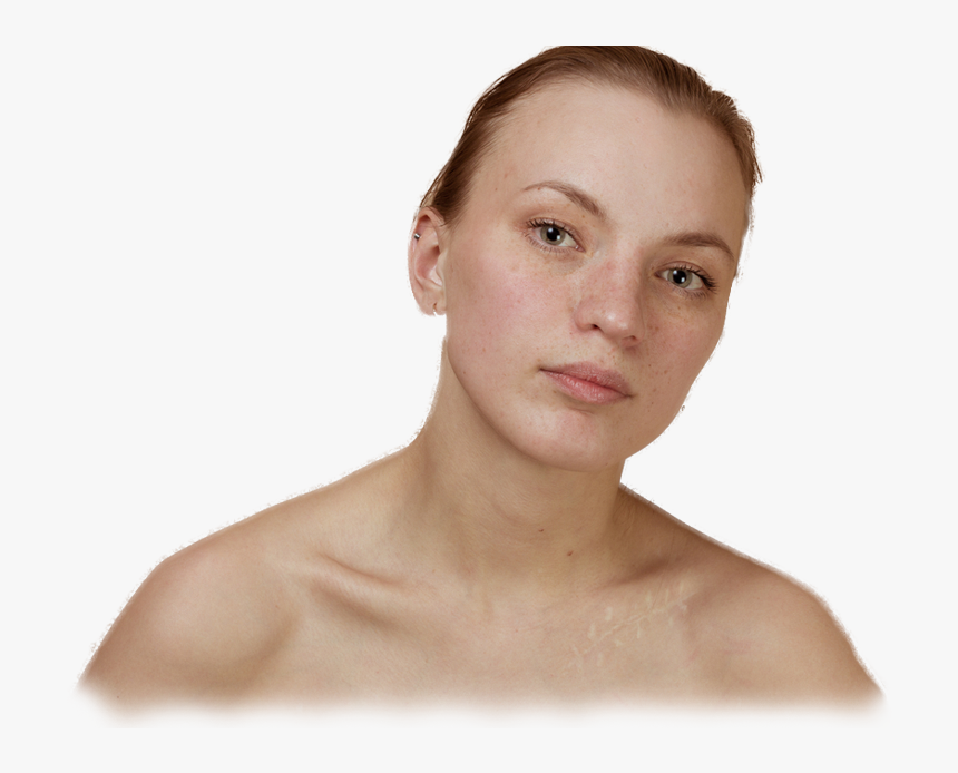 Transparent Realistic Scar Png - Barechested, Png Download ...