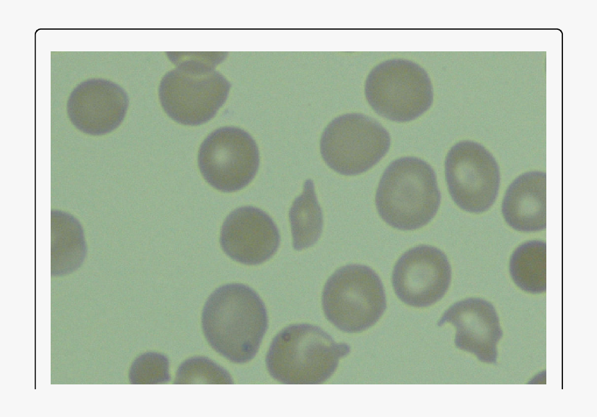 Blood Smear Png, Transparent Png , Transparent Png Image - PNGitem
