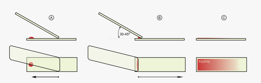 Blood Smear Png, Transparent Png , Transparent Png Image - PNGitem
