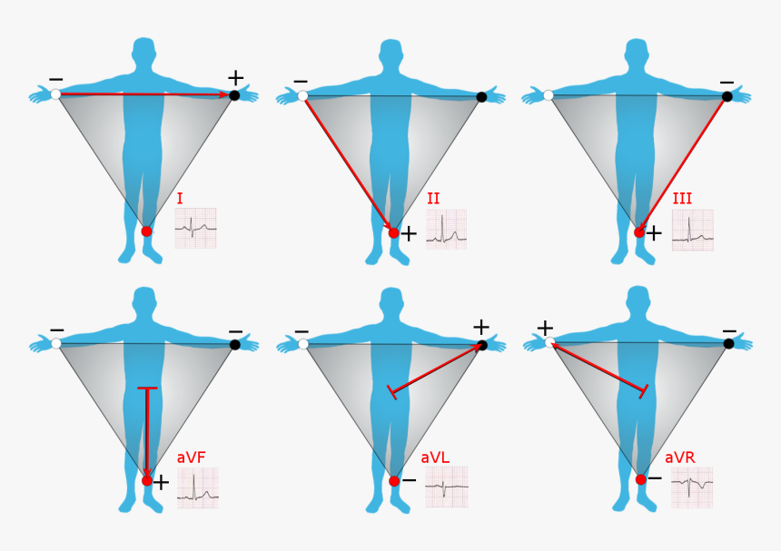 Ecg Limb Leads, HD Png Download , Transparent Png Image - PNGitem
