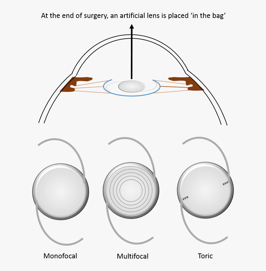 What Are Intraocular Lens, HD Png Download , Transparent Png Image ...