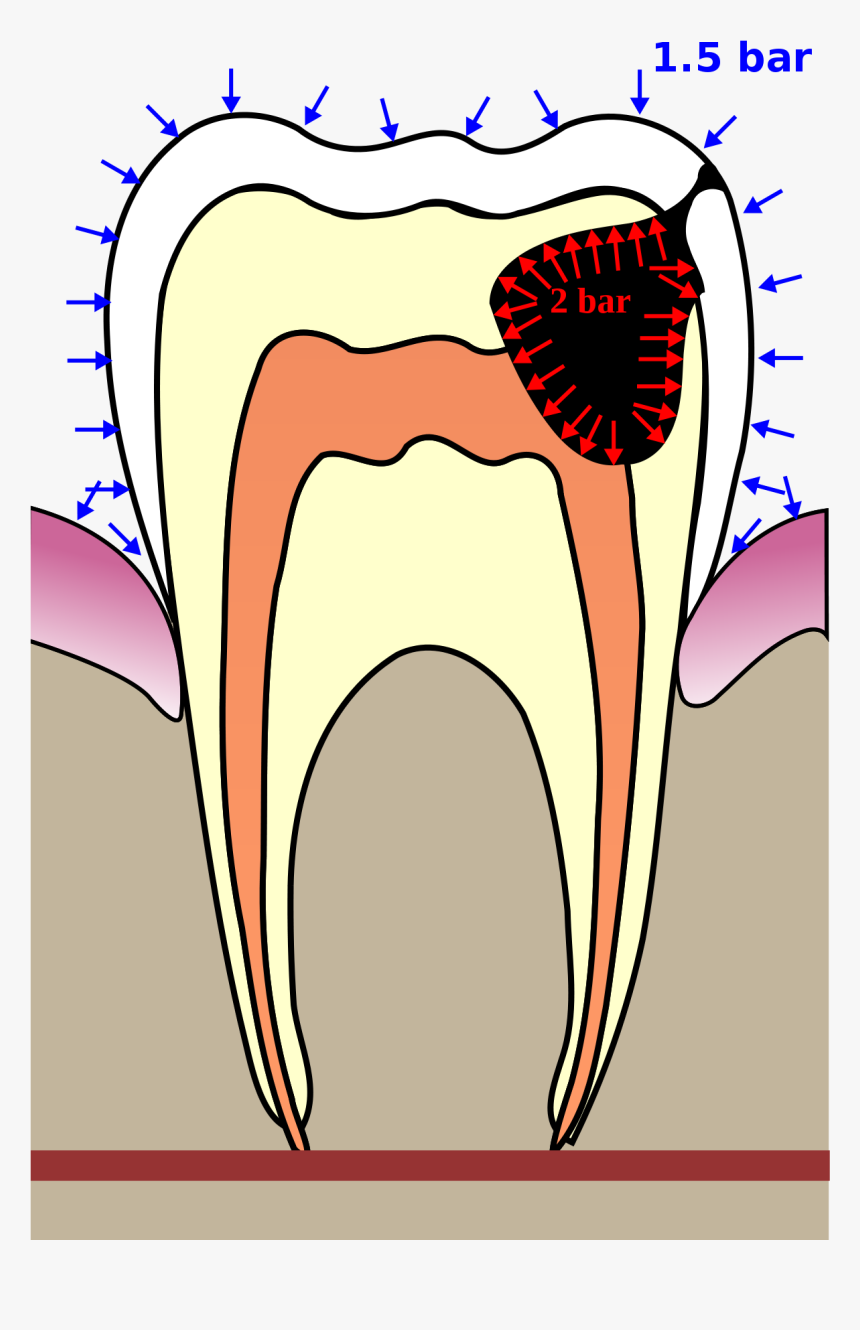 Tooth Squeeze While Diving, HD Png Download , Transparent Png Image ...