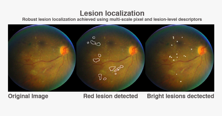 Transparent Google Eyes Png - Earth, Png Download , Transparent Png ...