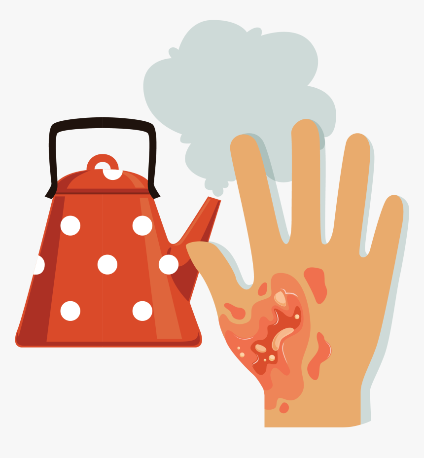 Burns First Aid Cartoon, HD Png Download , Transparent Png Image - PNGitem