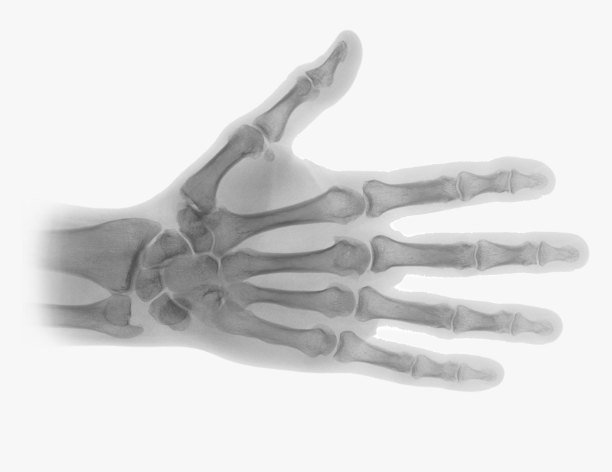 X-ray Transparent Image - Transparent X Ray Png, Png Download ...
