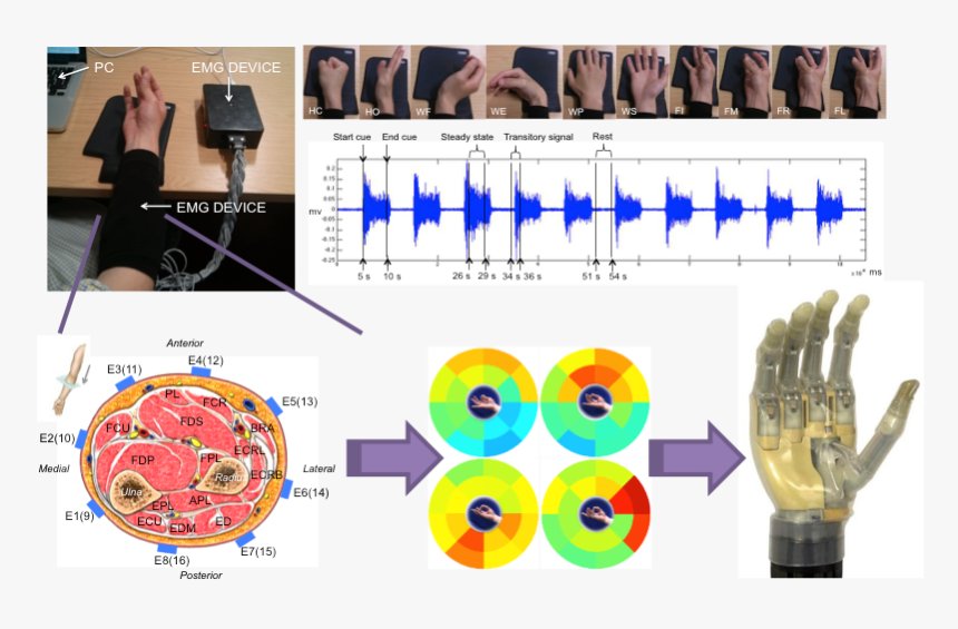 Emg-hand - Limb Hand, HD Png Download , Transparent Png Image - PNGitem