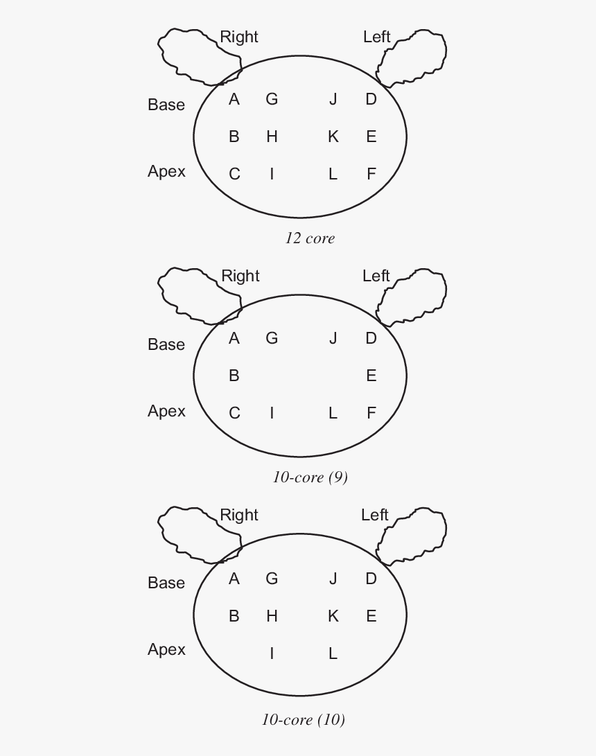 Left Lateral Apex Prostate, HD Png Download , Transparent Png Image ...