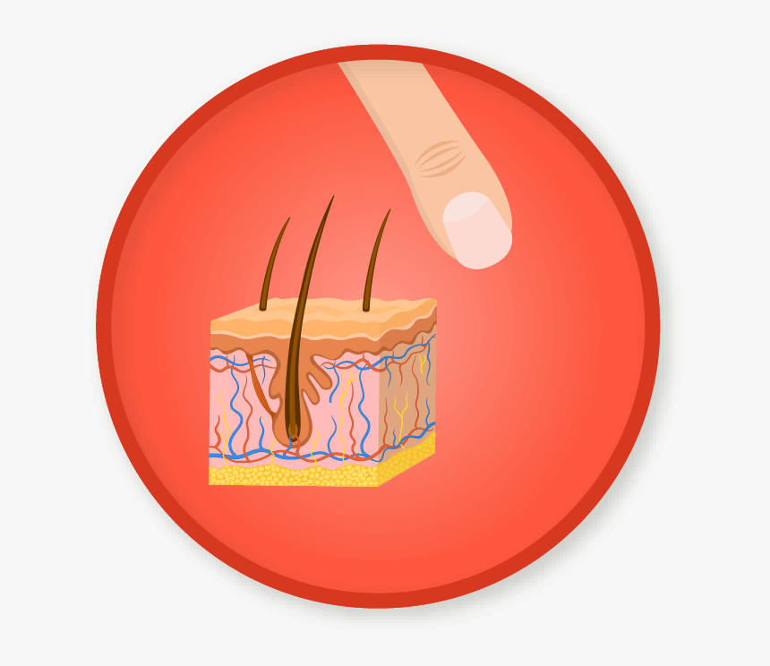 Picture Free Skin Clipart Integumentary System - Integumentary System ...