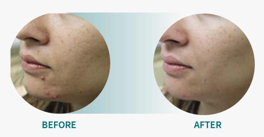 Transparent Face Scar Png, Png Download , Transparent Png Image - PNGitem