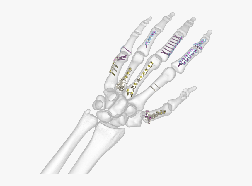 Transparent Bone Hand Png, Png Download , Transparent Png Image - PNGitem