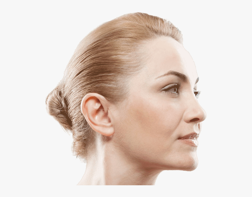 Non-surgical Facelift - Double Chin, HD Png Download , Transparent Png ...