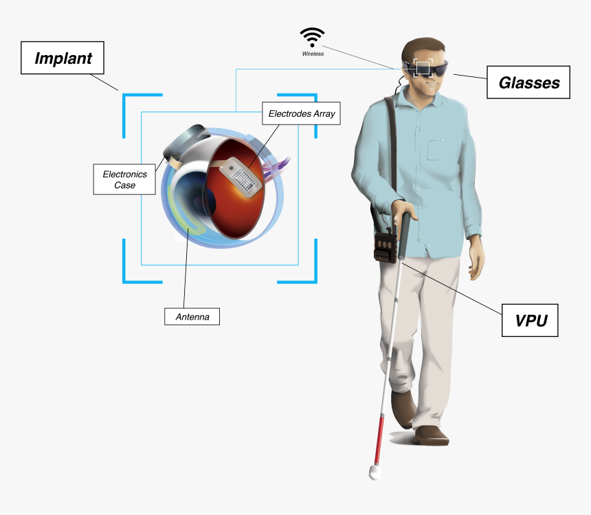 Argus Png, Transparent Png , Transparent Png Image - PNGitem