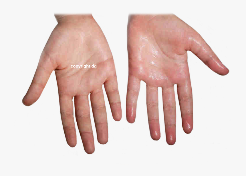 Excessive Sweating Png - Body Jewelry, Transparent Png , Transparent ...