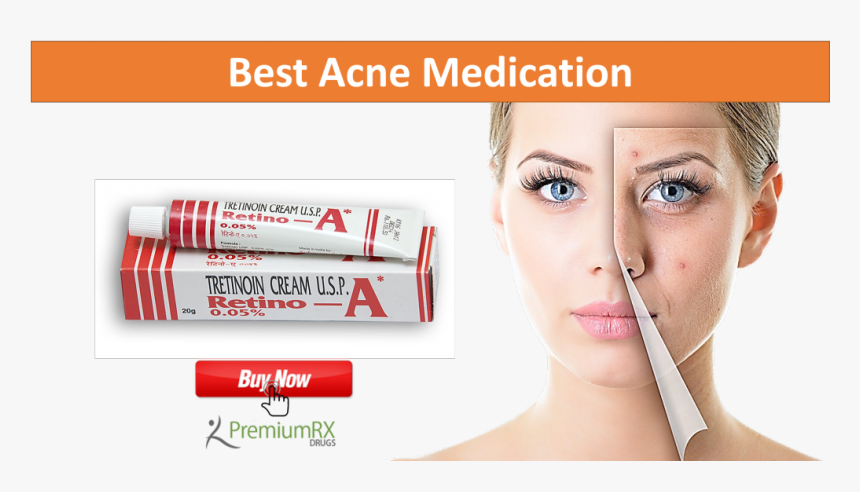 Hd Blemishes On Face, HD Png Download , Transparent Png Image - PNGitem