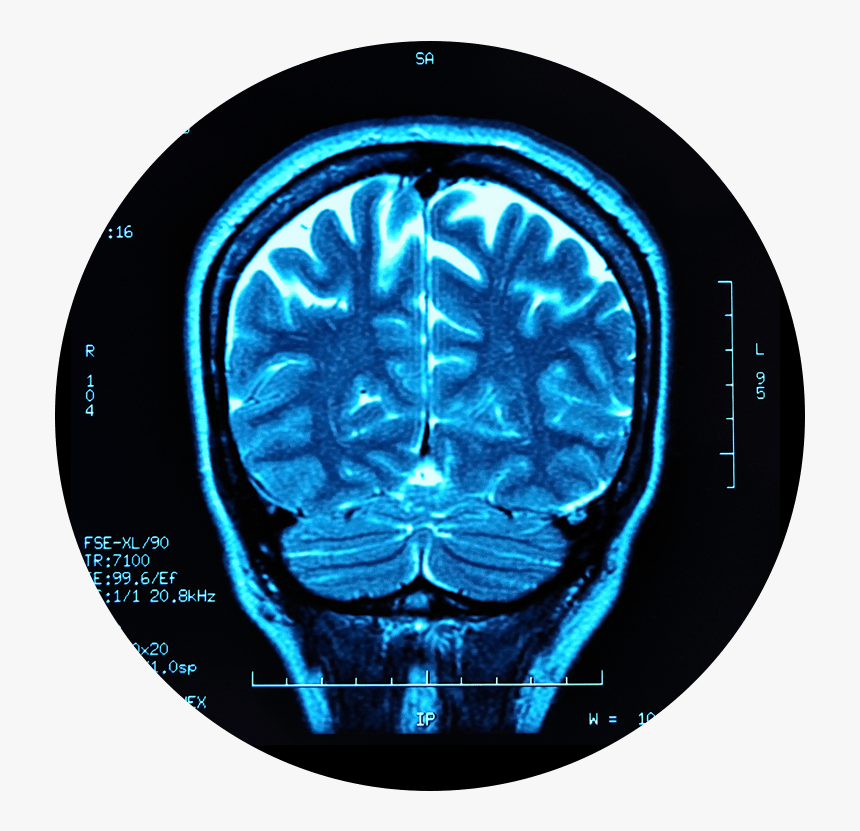 Traumatic Brain Injury , Png Download, Transparent Png , Transparent ...