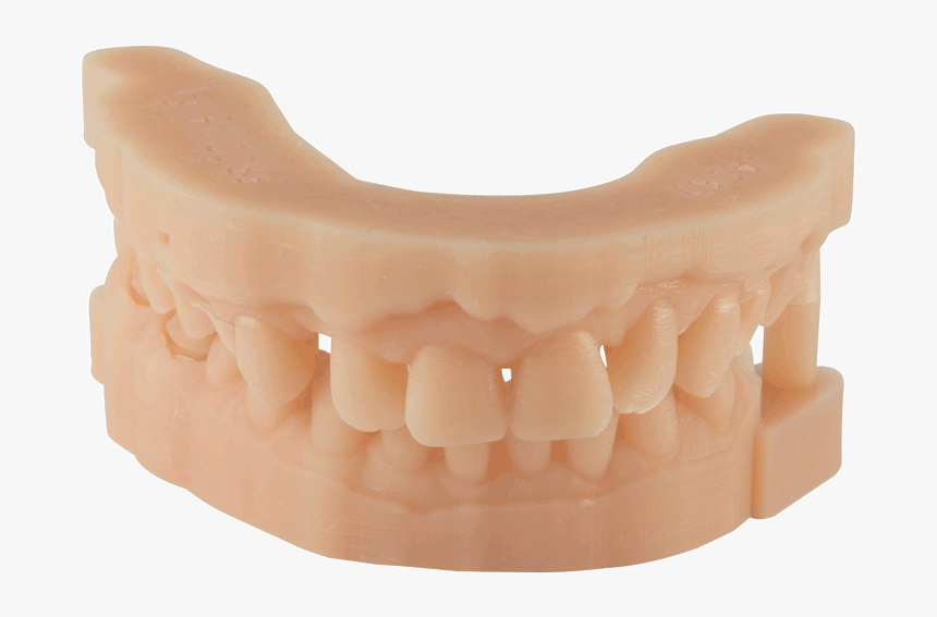 Dental D Material Prodways - 3d Printed Dental Model, HD Png Download ...