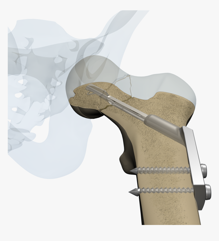 Trigger, HD Png Download , Transparent Png Image - PNGitem