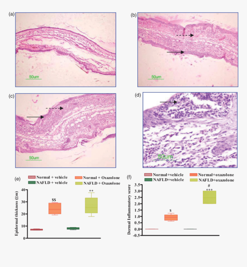 Transparent Mouse Ears Png - Mouse Ear Histology, Png Download ...
