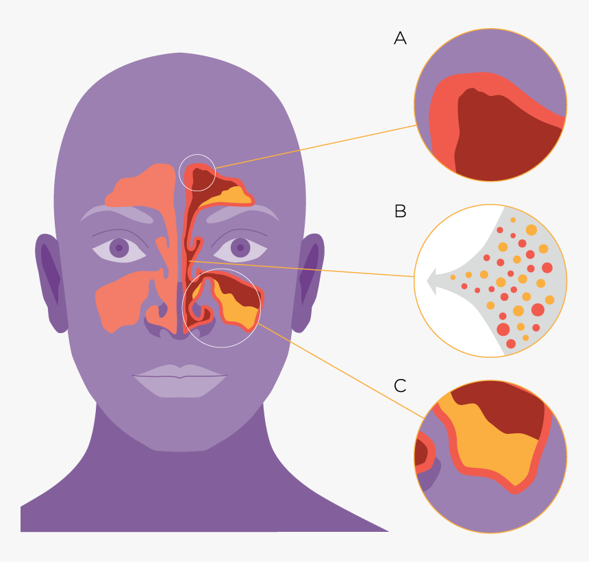 Cold Breath Png, Transparent Png , Transparent Png Image - PNGitem