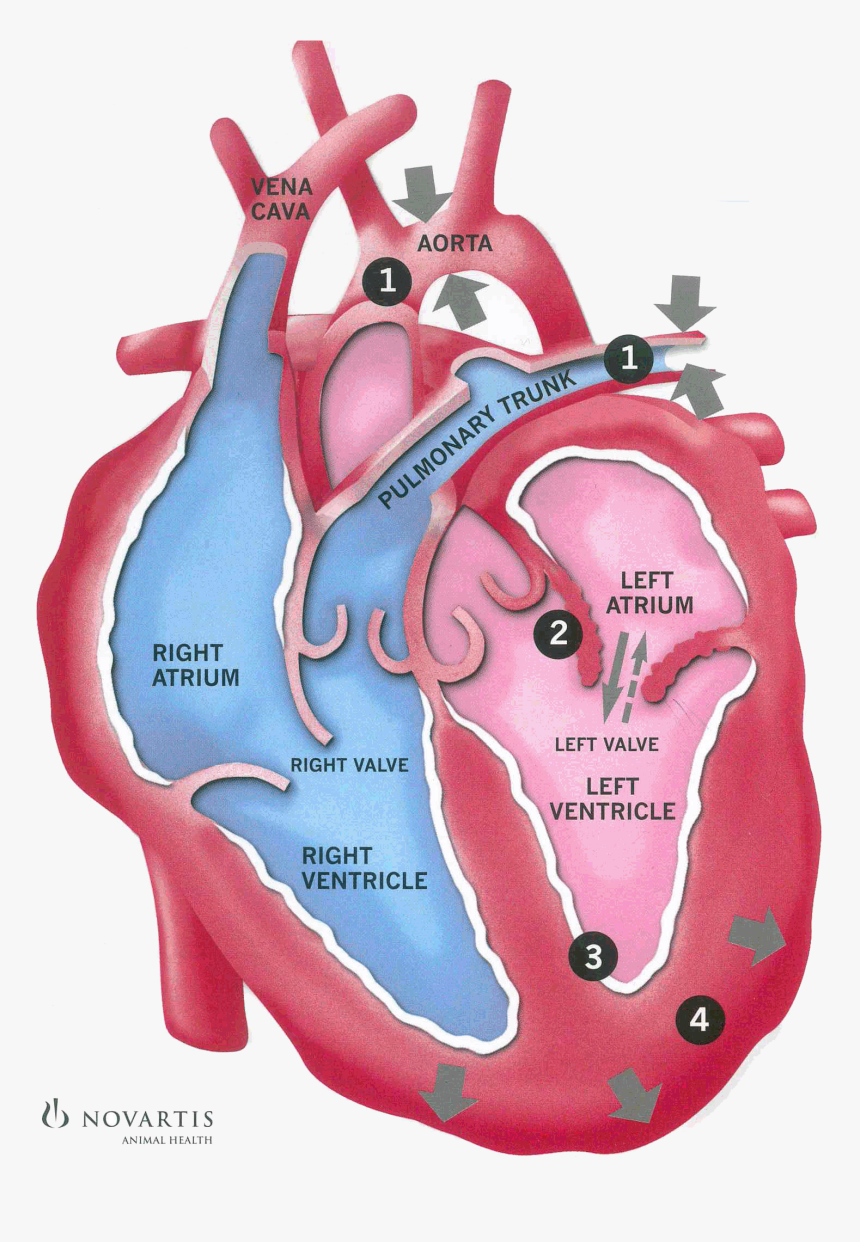 Clip Art Congestive Heart Failure Picture - Heart Failure Back Flow, HD ...