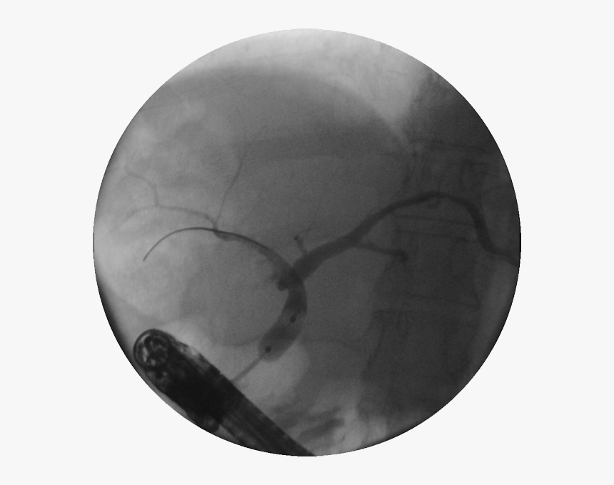 Hurricane Balloons, HD Png Download , Transparent Png Image - PNGitem