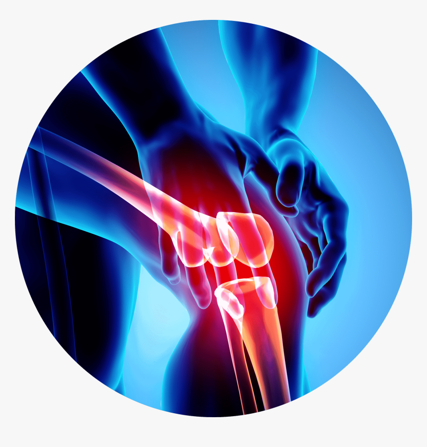 Knee Pain, HD Png Download , Transparent Png Image - PNGitem