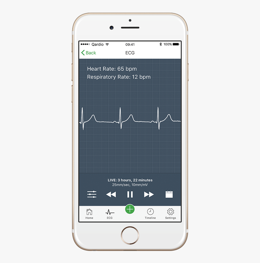 How To Read An Electrocardiogram - Atrial Fibrillation Holter Monitor ...