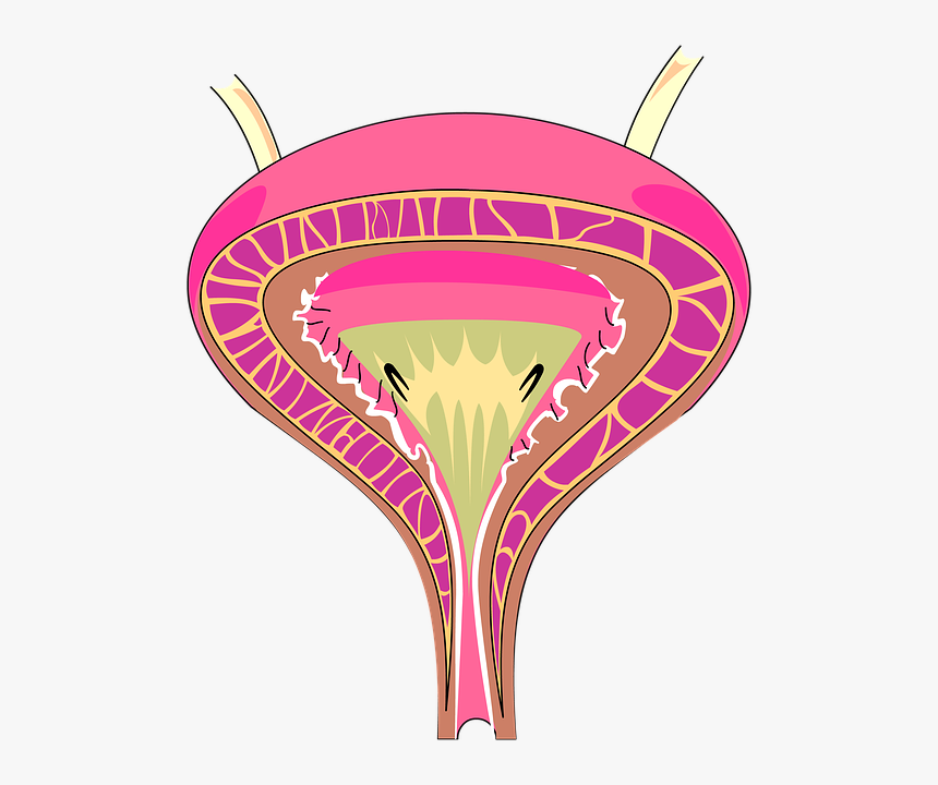 Interstitial Cystitis Clipart, HD Png Download , Transparent Png Image ...