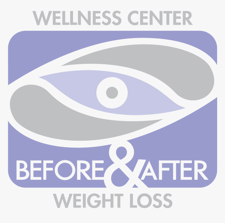 Before And After - Graphic Design, HD Png Download , Transparent Png ...