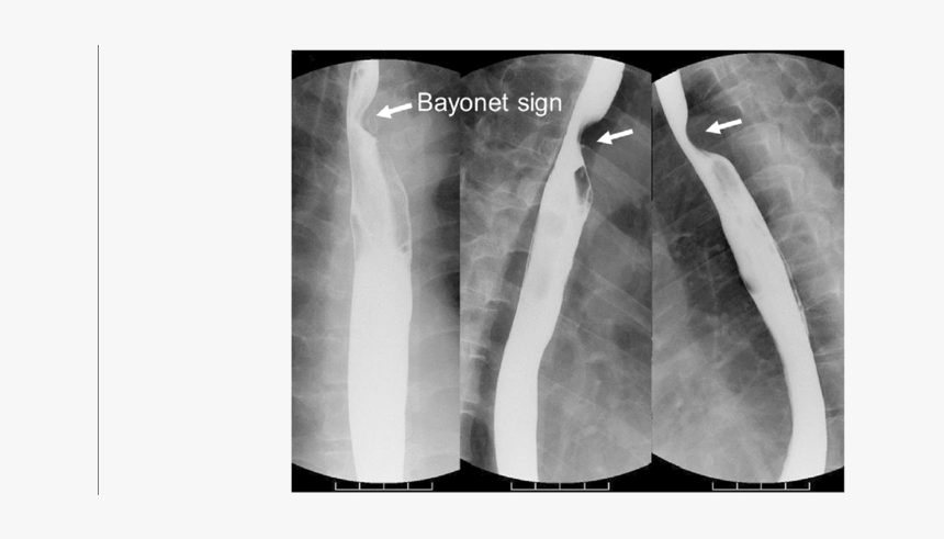Bayonet Png, Transparent Png , Transparent Png Image - PNGitem