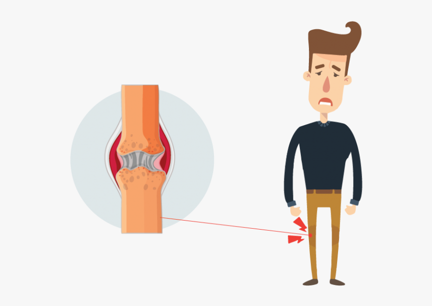 Transparent Knee Clipart - Cartoon, HD Png Download , Transparent Png ...