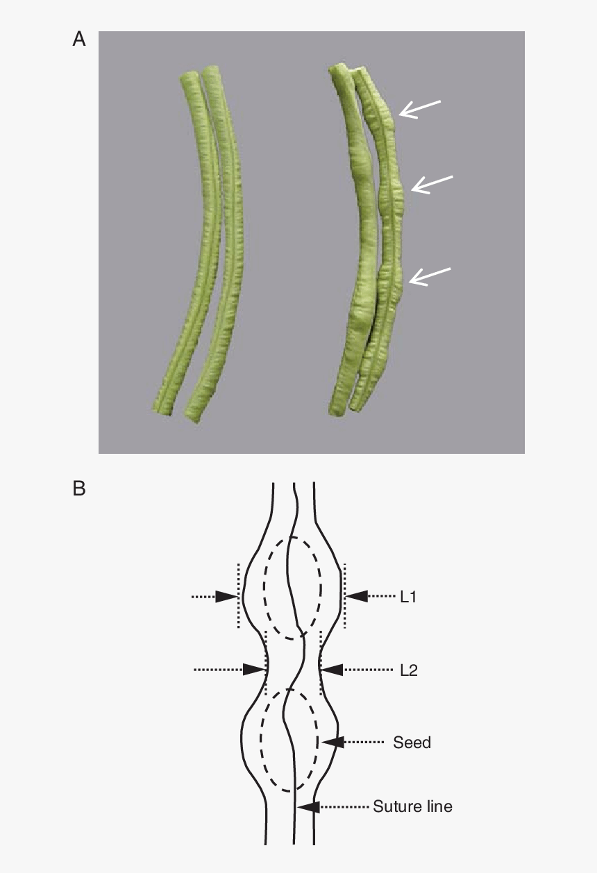 Difference Between Seed And Pod, HD Png Download , Transparent Png ...
