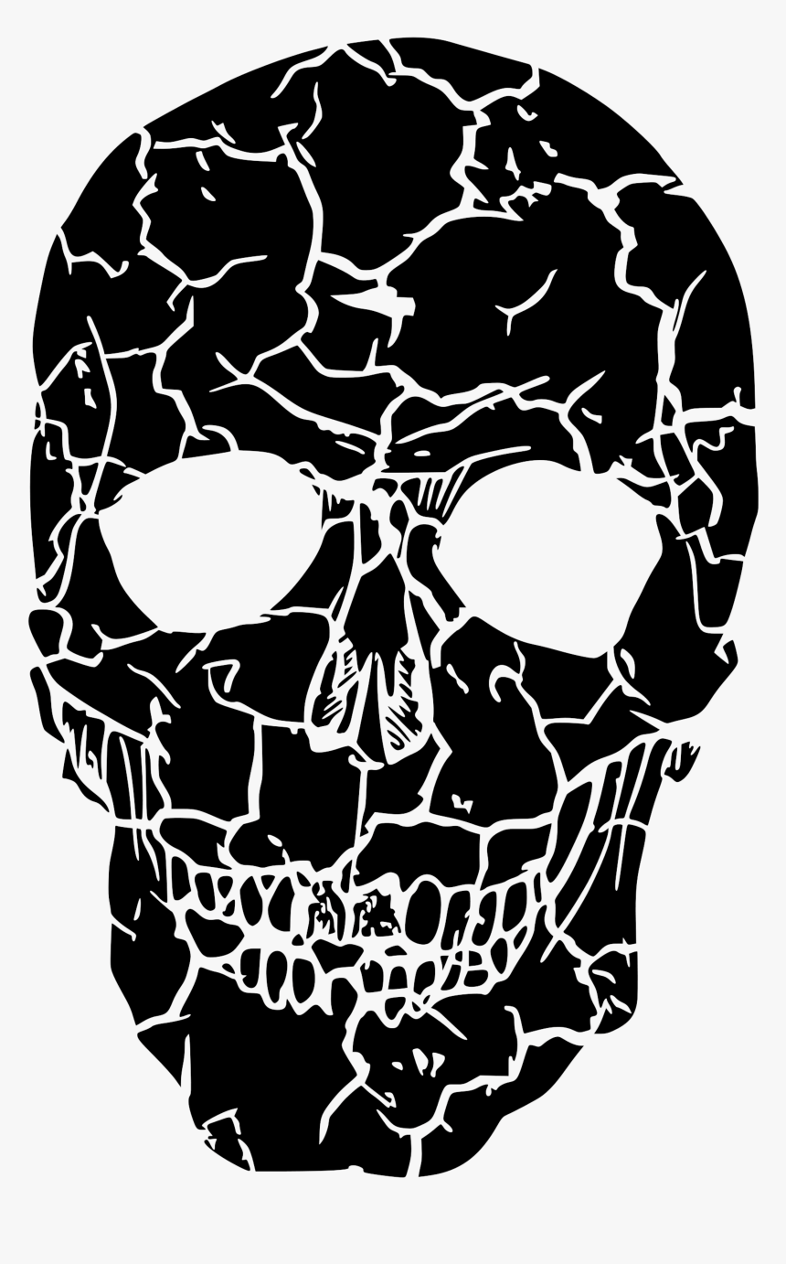 Xray Image Broken Skull Ap View Stock Photo 267581537