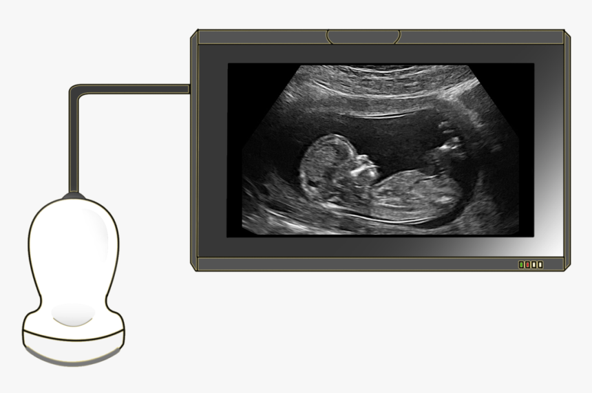 Ultrasound - Polyhydramnios Ultrasound, HD Png Download , Transparent ...
