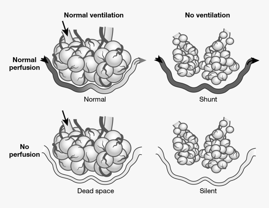 Dead Bush Png, Transparent Png , Transparent Png Image - PNGitem