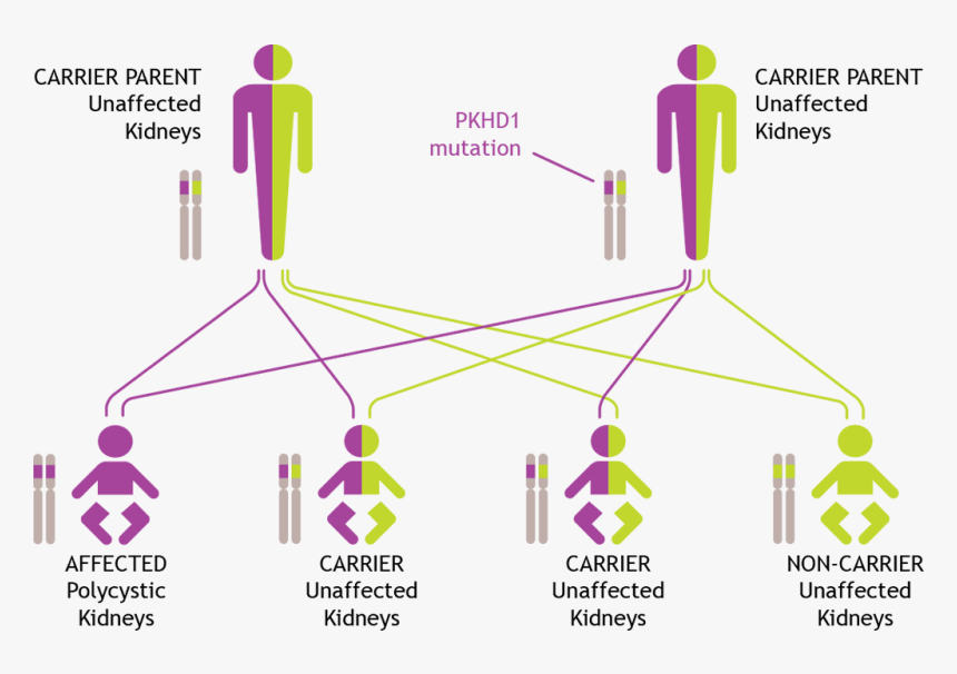 How Arpkd Is Inherited - Adpkd Genetics, HD Png Download , Transparent ...