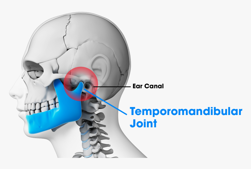 Tmj Treatment Denver - Broken Human Jaw Bone, HD Png Download ...