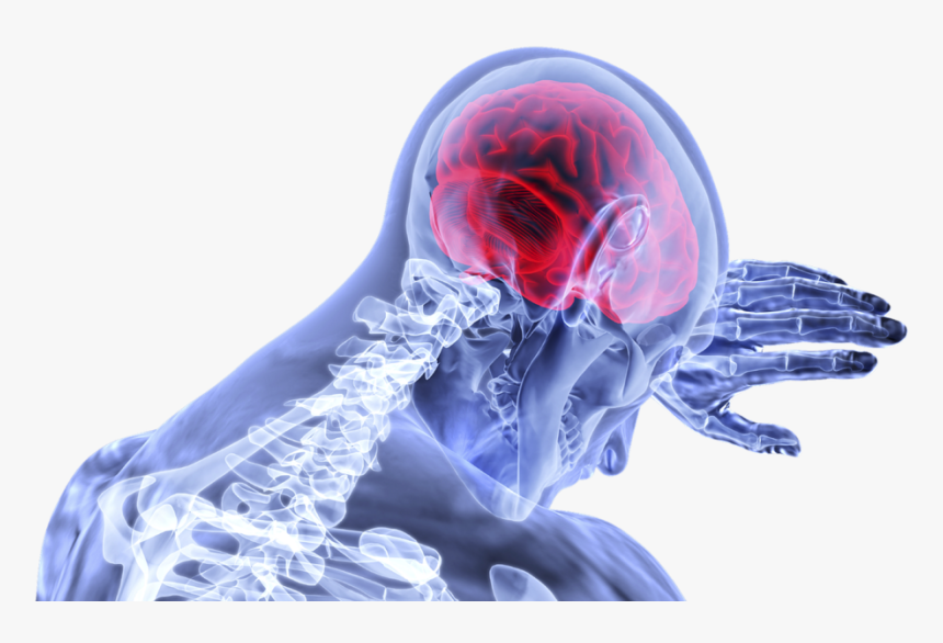Brain-3168269 1280 - Concussions Png, Transparent Png , Transparent Png ...