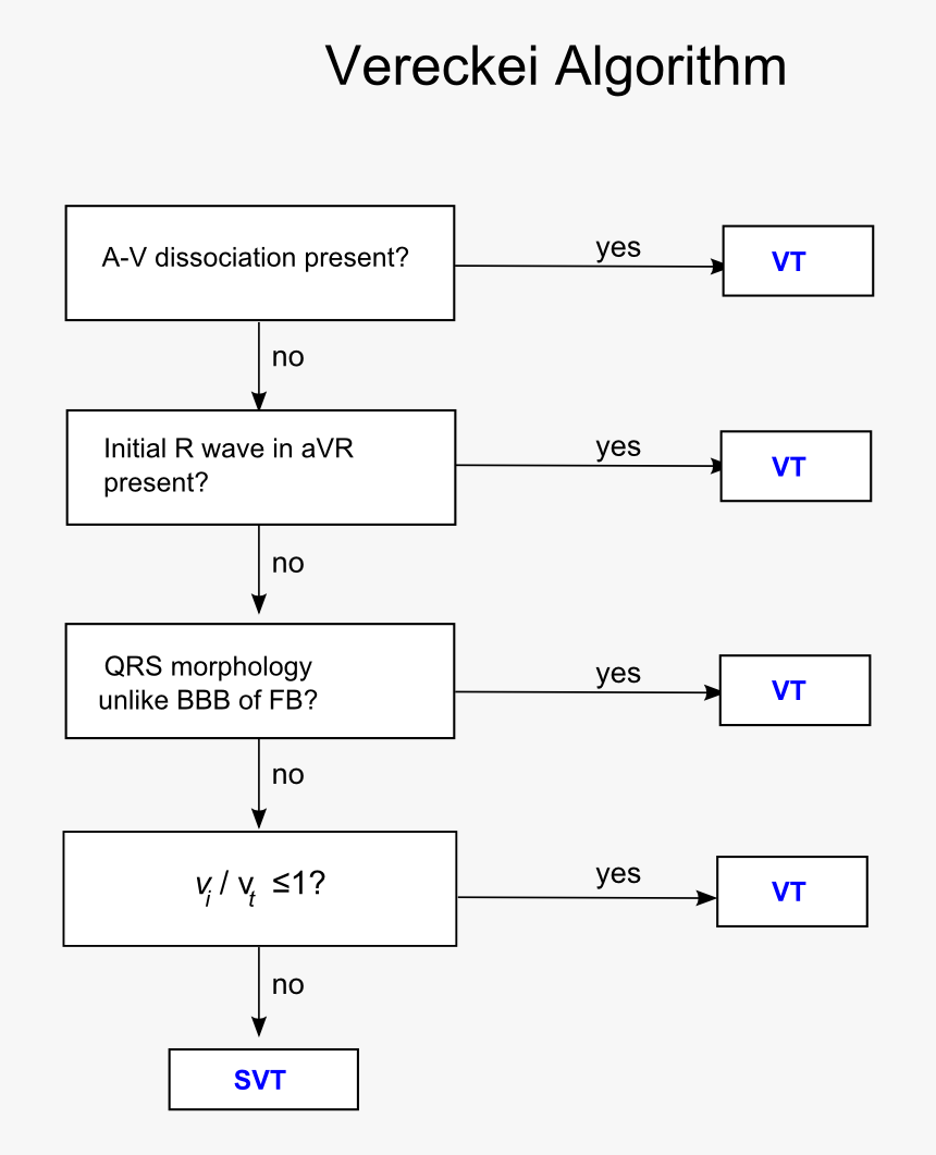 Sgarbossa Criteria Svt Vs Vt, HD Png Download , Transparent Png Image ...