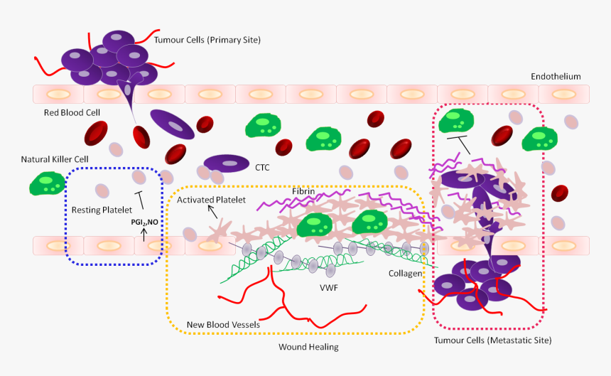 Platelets And Cancer Metastasis, HD Png Download , Transparent Png ...