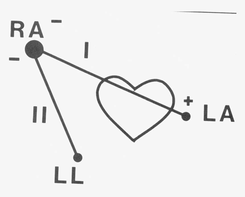 Modified V5 Lead 1, HD Png Download , Transparent Png Image - PNGitem